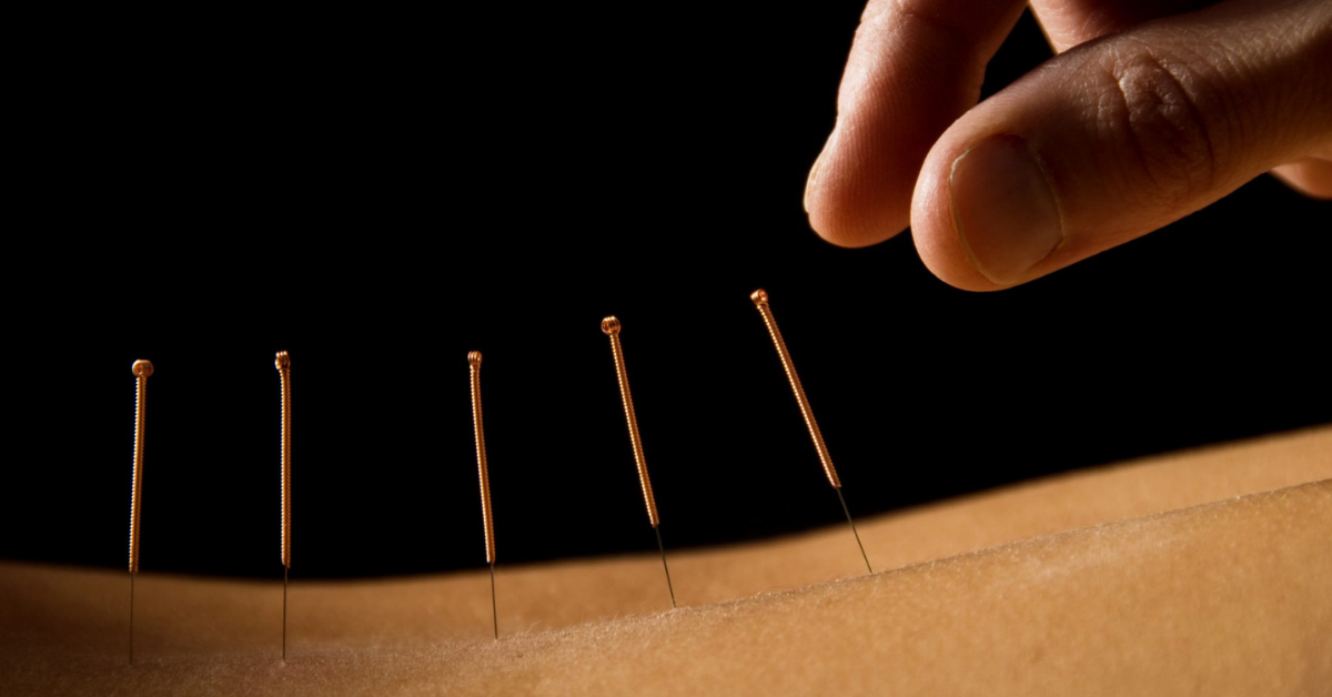 Cosmetic Acupuncture | Hornburg Holistics Acupuncture | Powder Springs